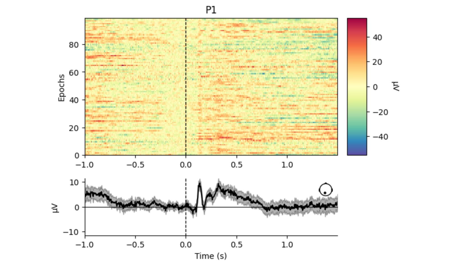 Event Related Potentials - Data Crayon Event Related Potentials - Data Crayon